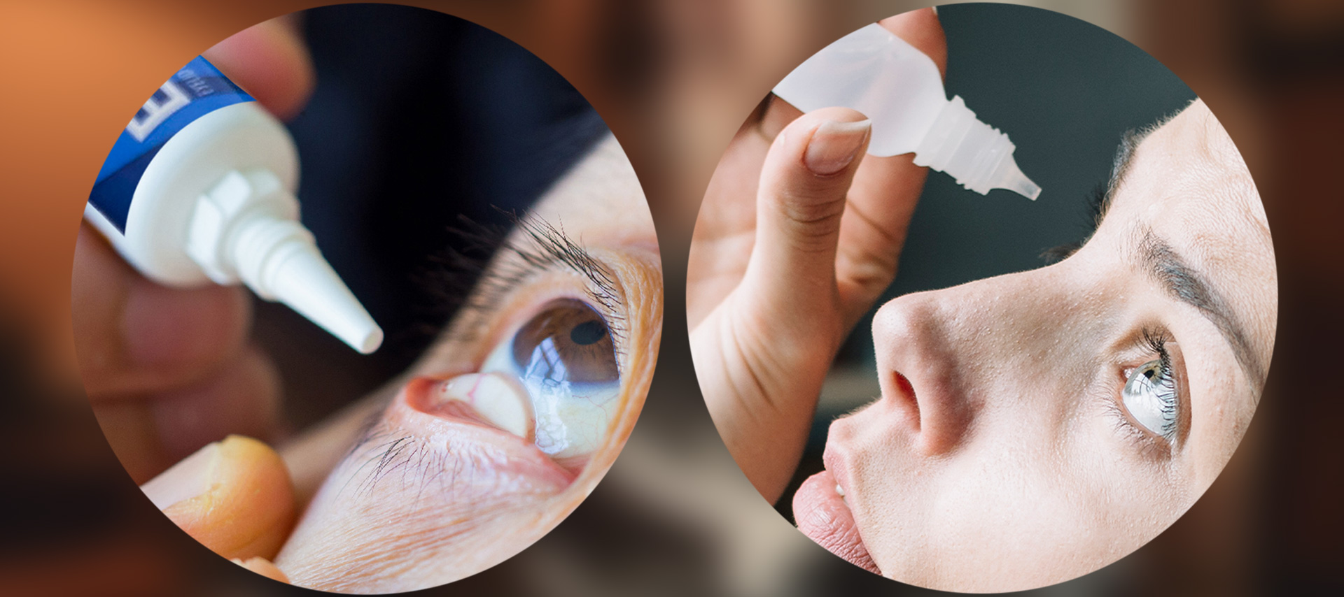 Comparative Efficacy of Traditional Eye Drops and EYELIVIO Care Pack